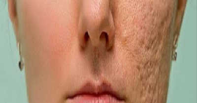 Healthy - centrals: RUB THIS ON ANY SCAR, WRINKLE, OR STAIN ON YOUR ...