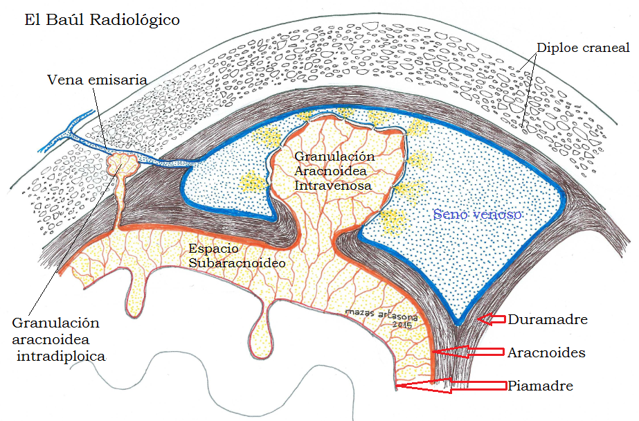 El Baúl Radiológico: 1) GRANULACIONES ARACNOIDEAS. GRANULACIONES DE ...