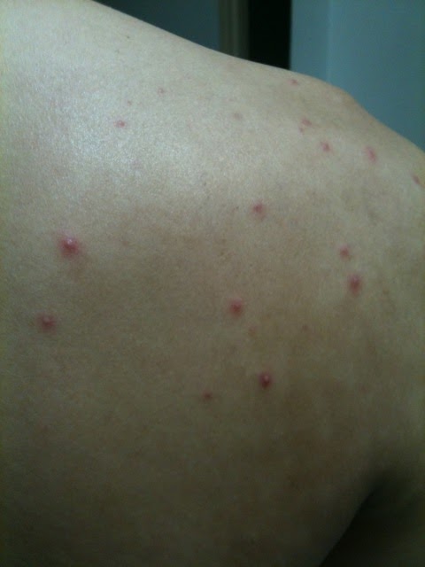 Cancer - Living with it.: What is Chemotherapy?