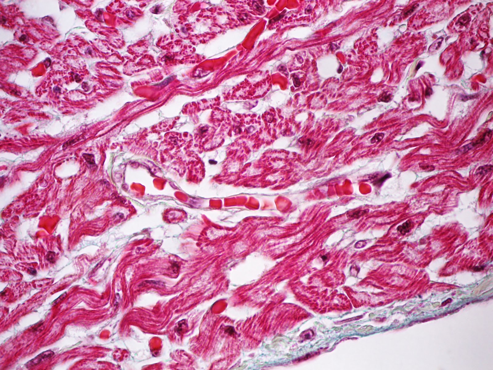 El músculo - Biología