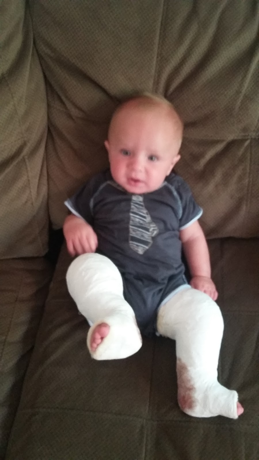 Andrew, Jonathan & Alexander: Baby with Casts