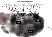 M É D E C I N E DE A-Z: Anatomie du système auditif
