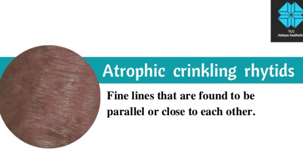 Skin Whitening Remedies