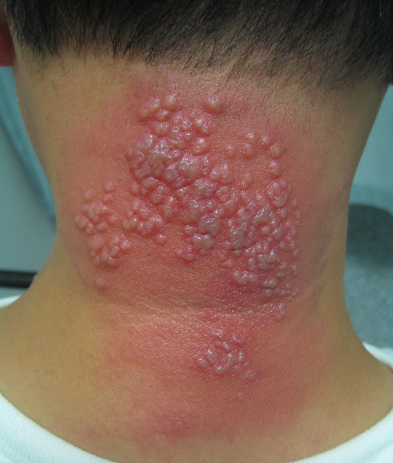 dr.Lestari Rahmah, MKT: RUAM KULIT