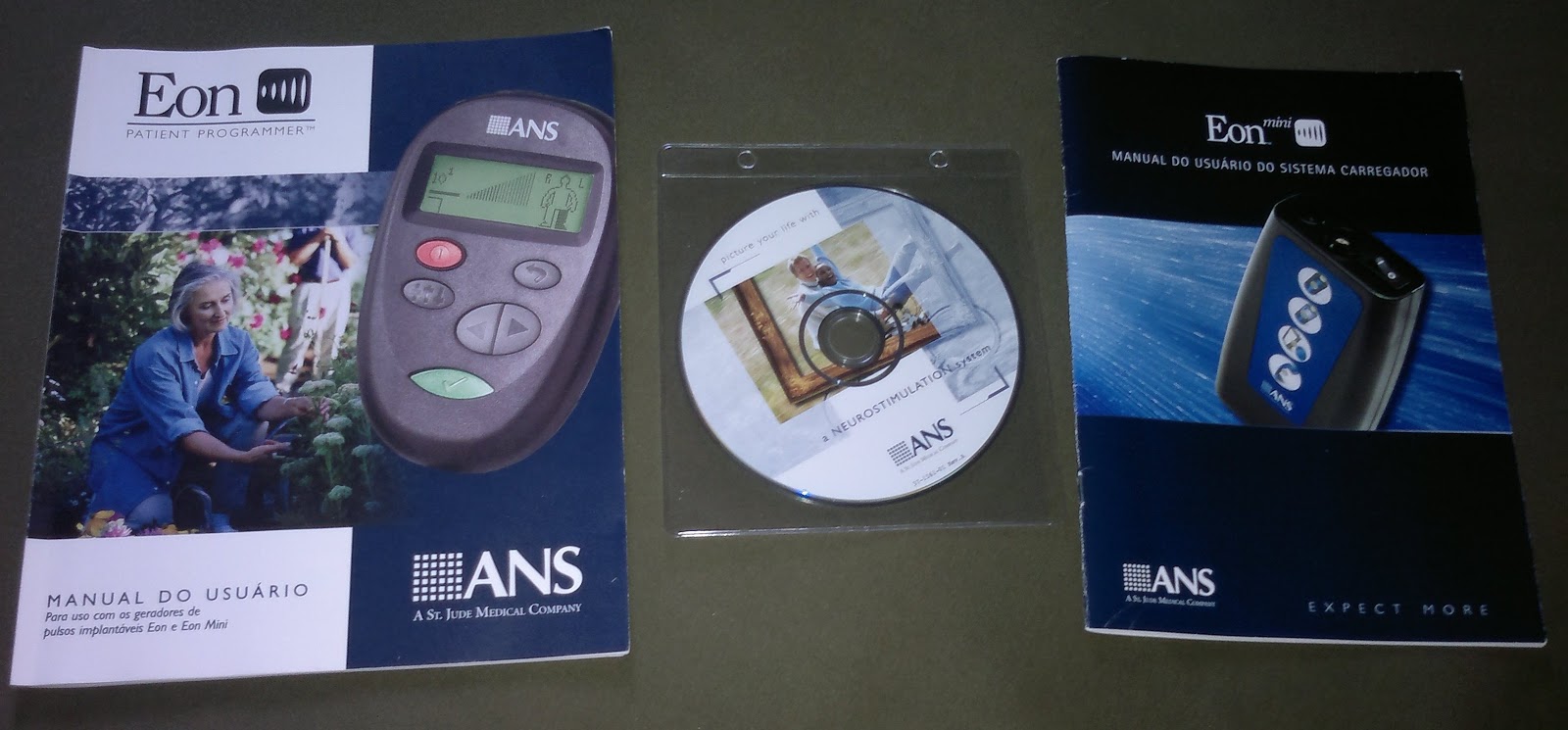 Síndrome Dolorosa Complexa Regional: Neuroestimulador Eon Mini