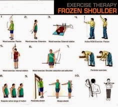Frozen Shoulder ~ PHYSICAL THERAPY