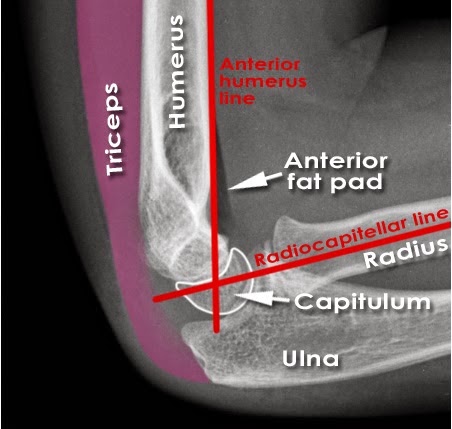 Musculoskeletal Emergency Medicine