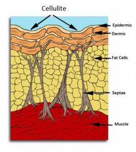 QUICK BODY TRANSFORMATION: Get rid of cellulite - The truth!