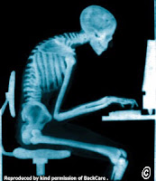 Health and Fitness Info with Joe Rouse: How Sitting & Poor Posture Can ...