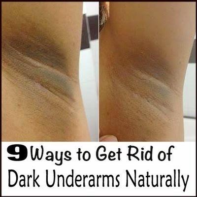 Natural Ways to Get Rid of Dark Underarms | Tips Park