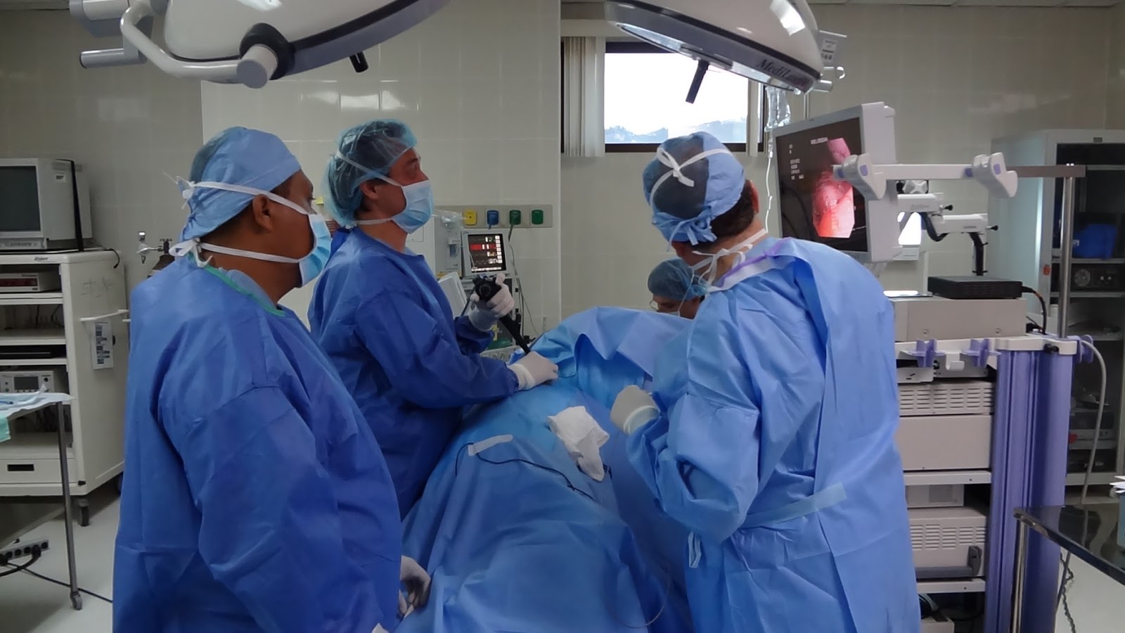 TORACOSCOPÍA MÉDICA - Neumología Intervencionista