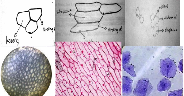 Pengamatan Perbedaan Sel Mati, Sel Tumbuhan, dan Sel Hewan