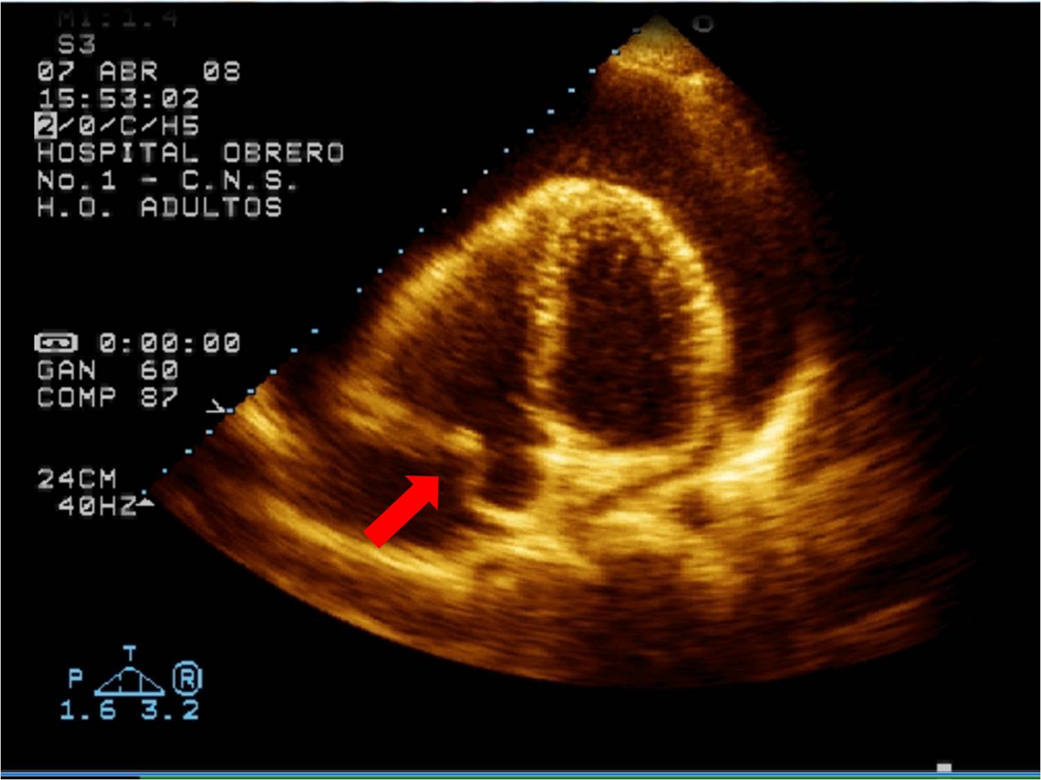 CARDIOLOGÍA: Material Apoyo