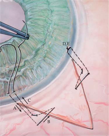 GLAUCOMA SPECIALIST BLOG: "THE GLOG"