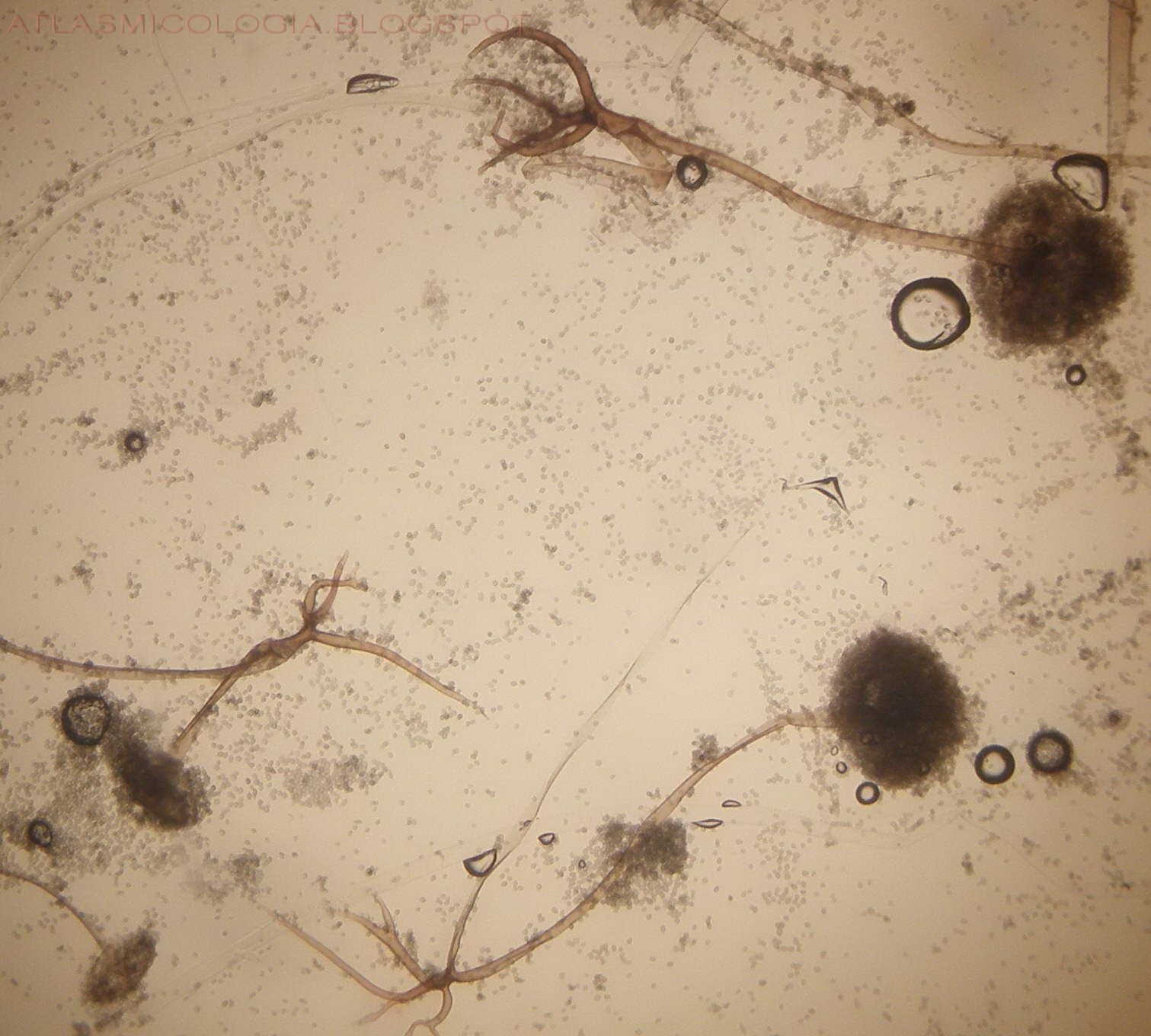 ATLAS MICOLOGIA: RHIZOPUS SP.