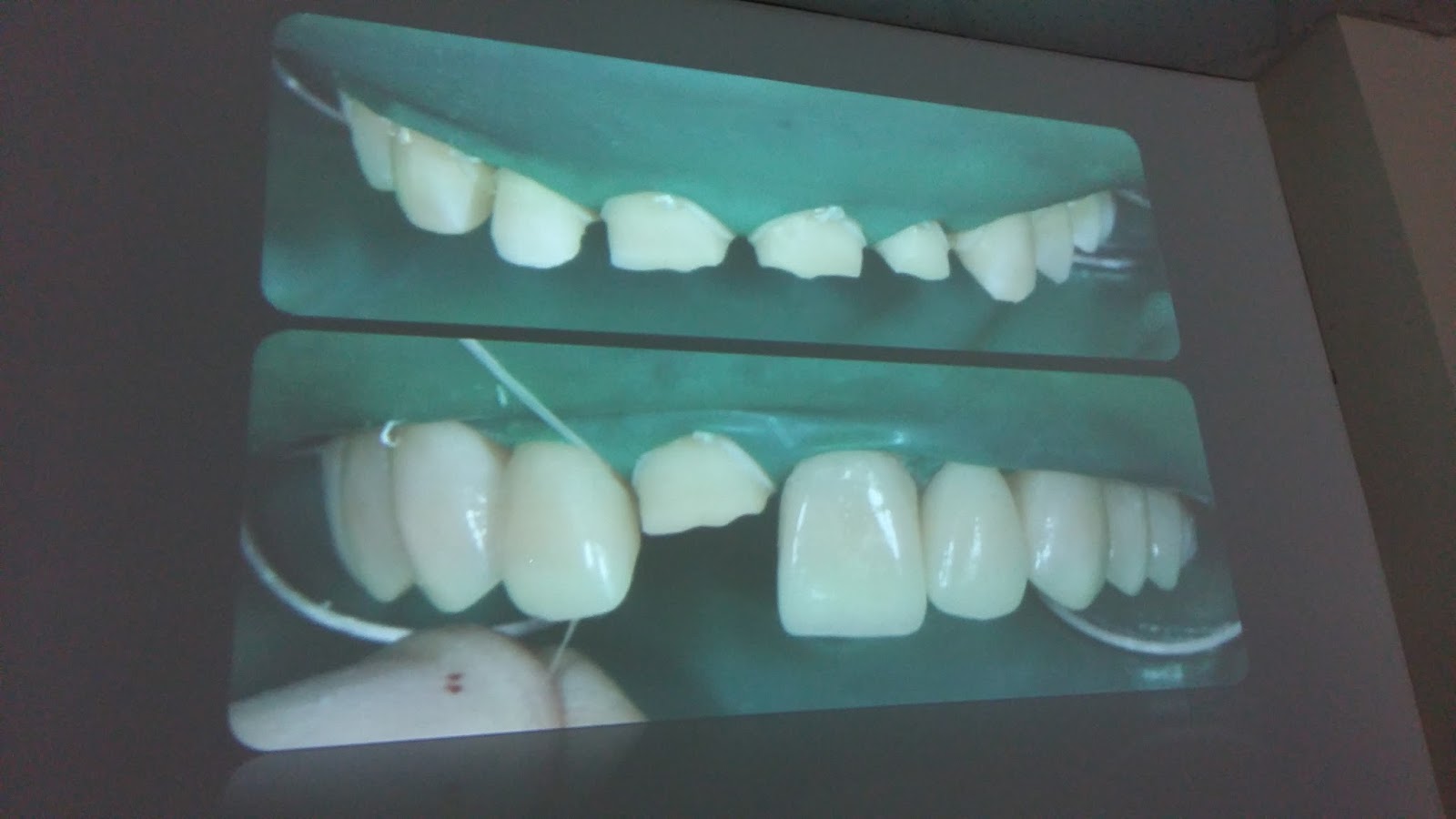 Стоматология для студентов