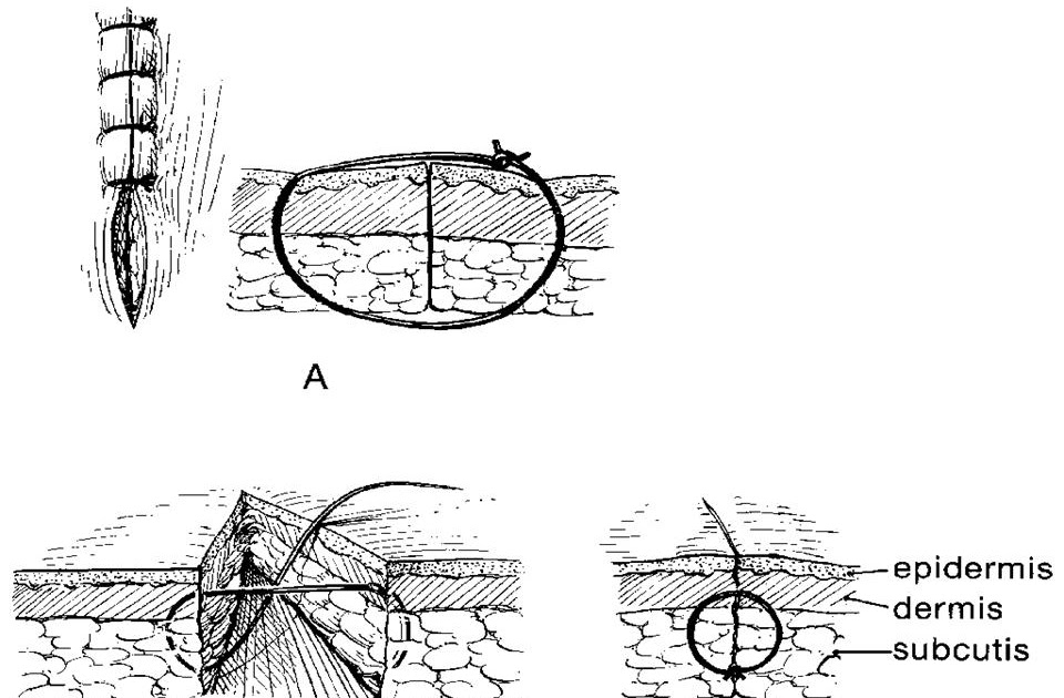 Cranial Sutures