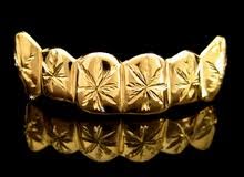 ANYTHING UNDER THE SUN: Things You Want to Know About Permanent Gold Teeth