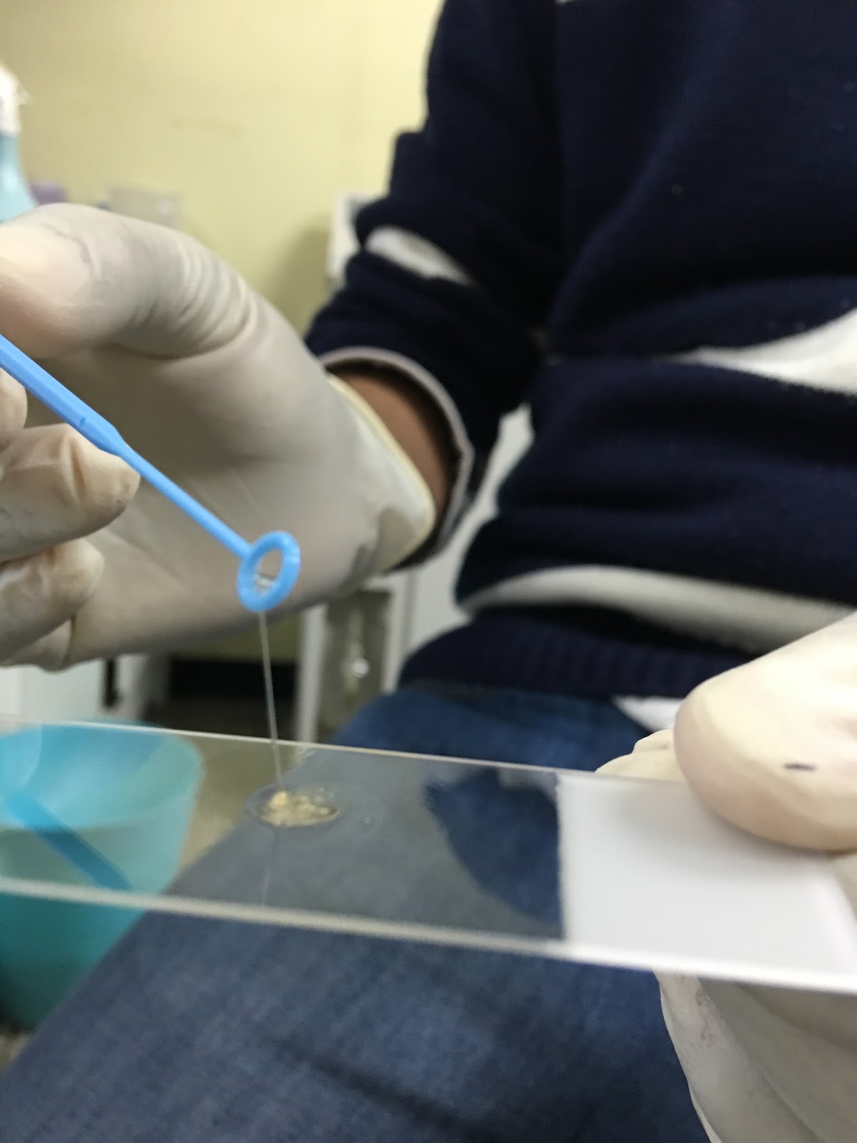 Protocol for Gram Staining ~ Dhiraj's Blog