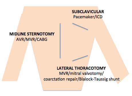 Prosthetic Valves in PACES - MRCP Revision Notes
