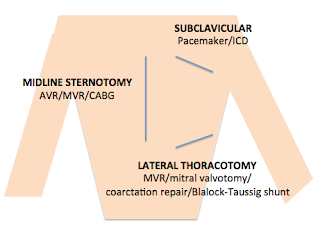 Prosthetic Valves in PACES - MRCP Revision Notes