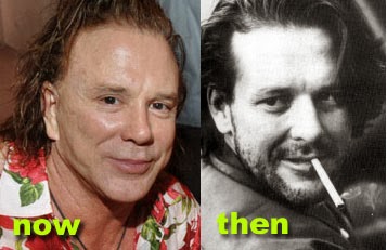 Women: Mickey Rourke Plastic Surgery