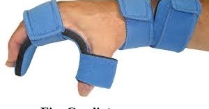 C- splint