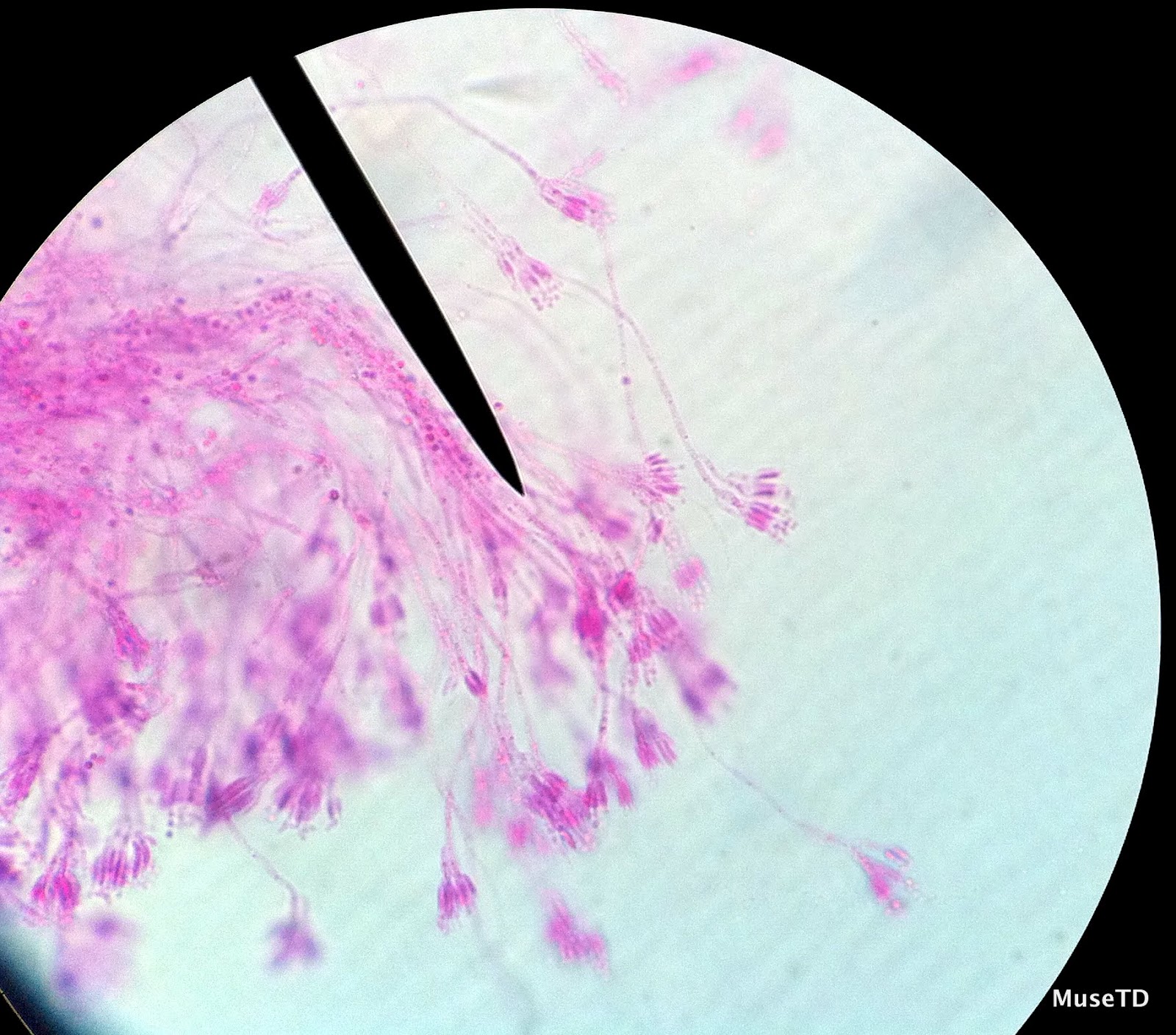 MICROBIOLOGY SLIDE SPECIMENS