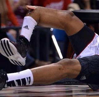 Kevin Ware's broken leg injury - YouPinoys