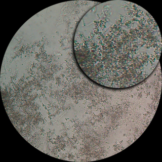 AMORF ÜRAT KRİSTALİ - Microbiology Laboratory Turkey