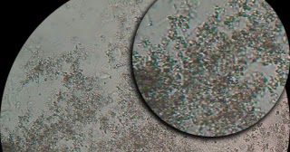 AMORF ÜRAT KRİSTALİ - Microbiology Laboratory Turkey