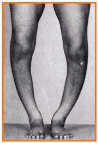 UJIAN SISTEM PENCERNAAN KELAS XI - Biology Page