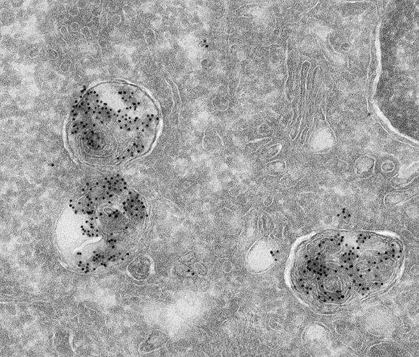 Enfermedades Raras: I - Cell