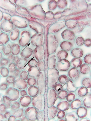 Fruity Updates........By IIDSians: Parenchyma cells