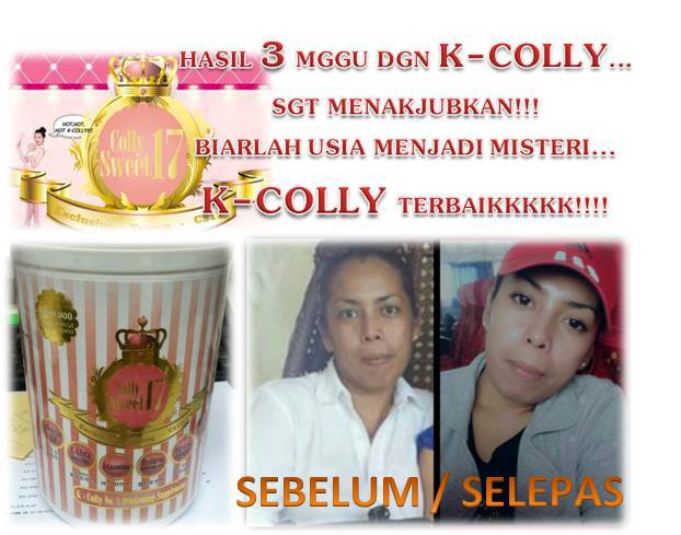 Rich Scha Beauty Collections: K-COLLY SWEET 17 1.5 JUTA MG