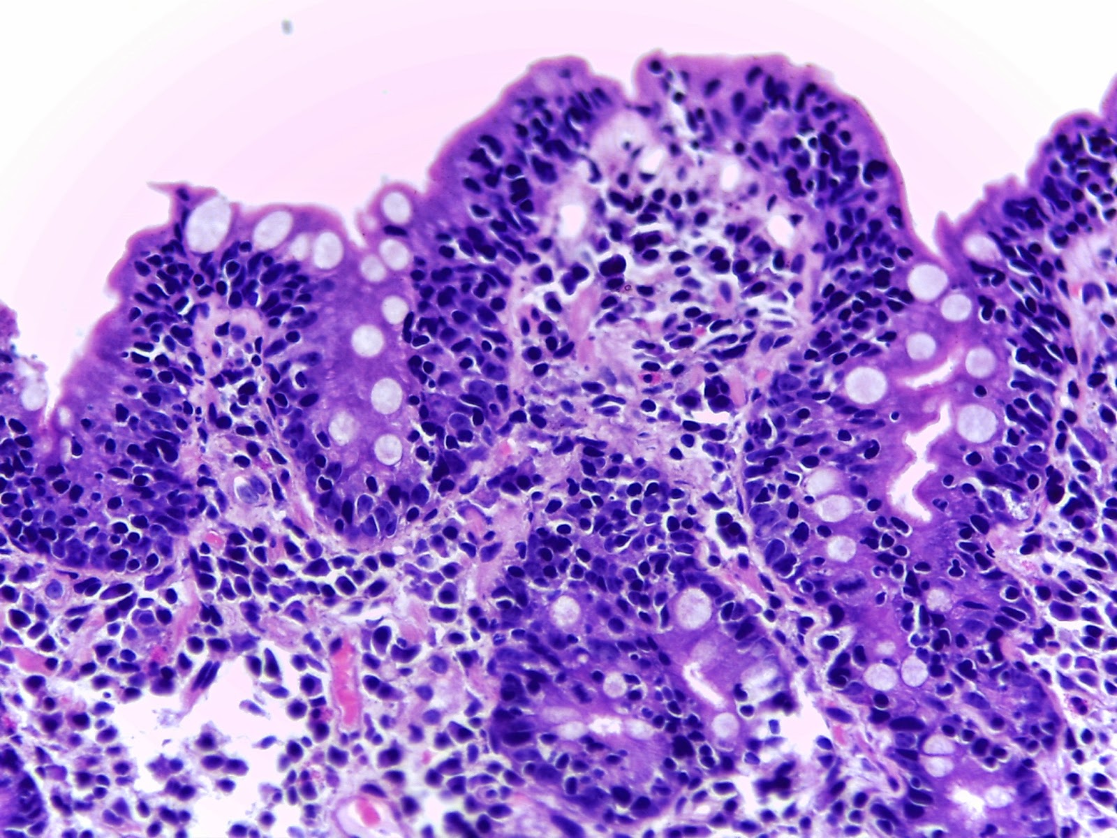 GASTROINTESTINAL AND LIVER HISTOLOGY PATHOLOGY ATLAS: DUODENUM: VILLOUS ...