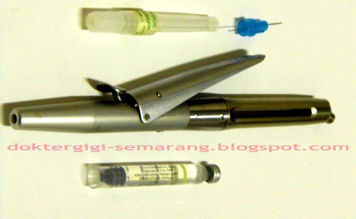 Konsultasi Gratis Dokter Gigi: ALAT ANESTESI GIGI : Citoject