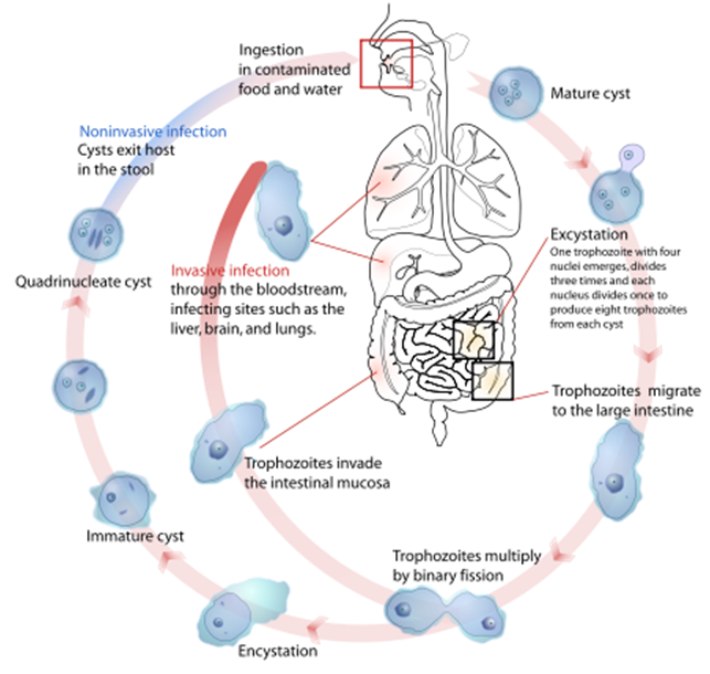 MBBS Medicine (Humanity First): Amoebic Liver Abscess