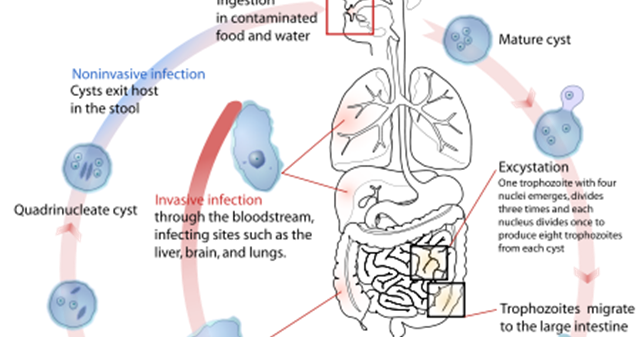 MBBS Medicine (Humanity First): Amoebic Liver Abscess