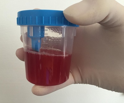 O que a cor da urina indica sobre a saúde de uma pessoa? - Saber Atualizado