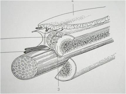GENERAL SURGEON: GROIN FLAP