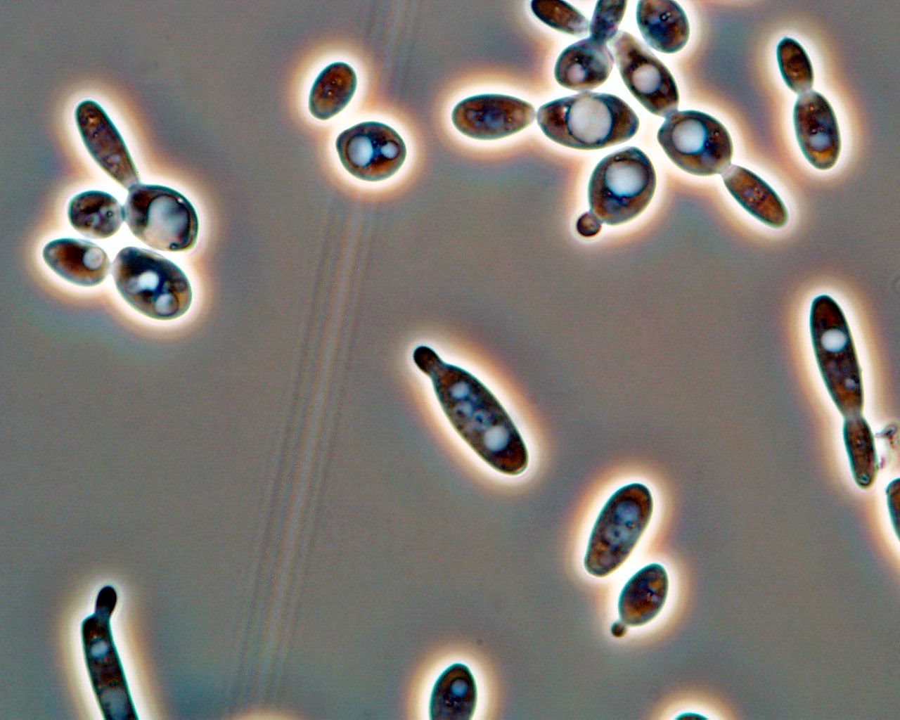 Microbiología UMH: 2014-05-25