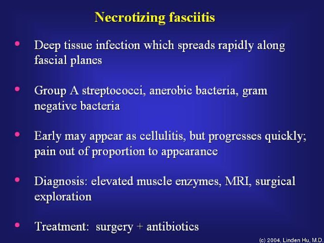 Redefining the Face Of Beauty : A RARE SKIN EATING BACTERIA ...