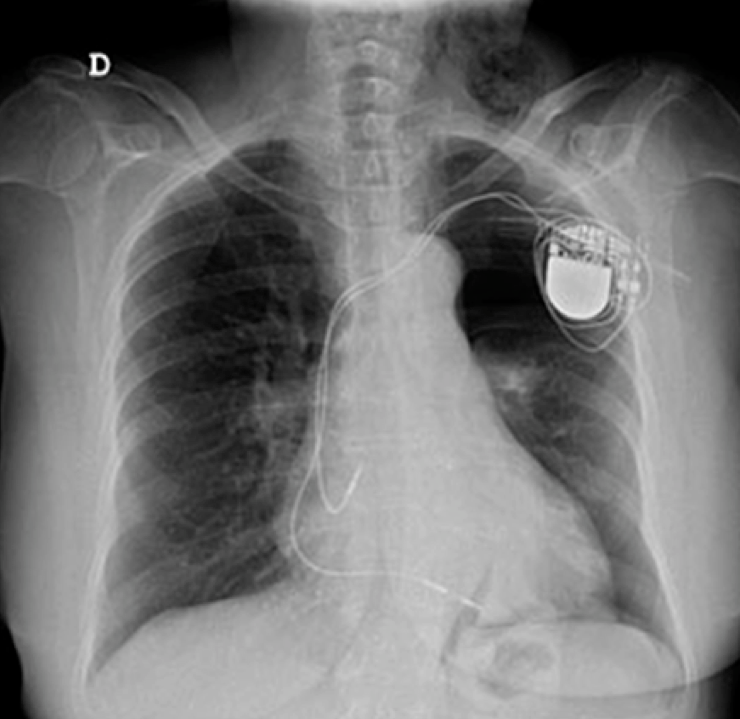 Dermapixel: junio 2017