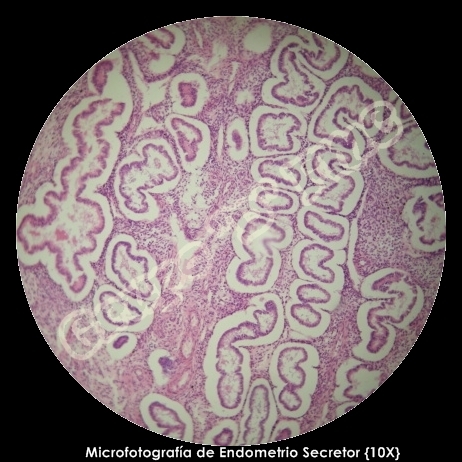 Histologeando: ENDOMETRIO