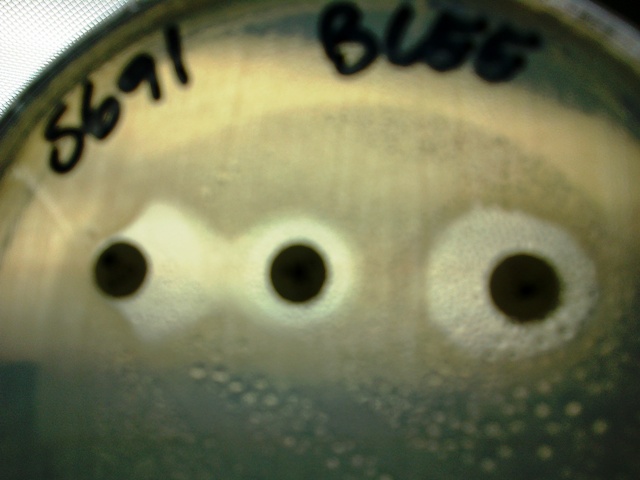 Microbiología Clínica: clases, casos interesantes y otros.