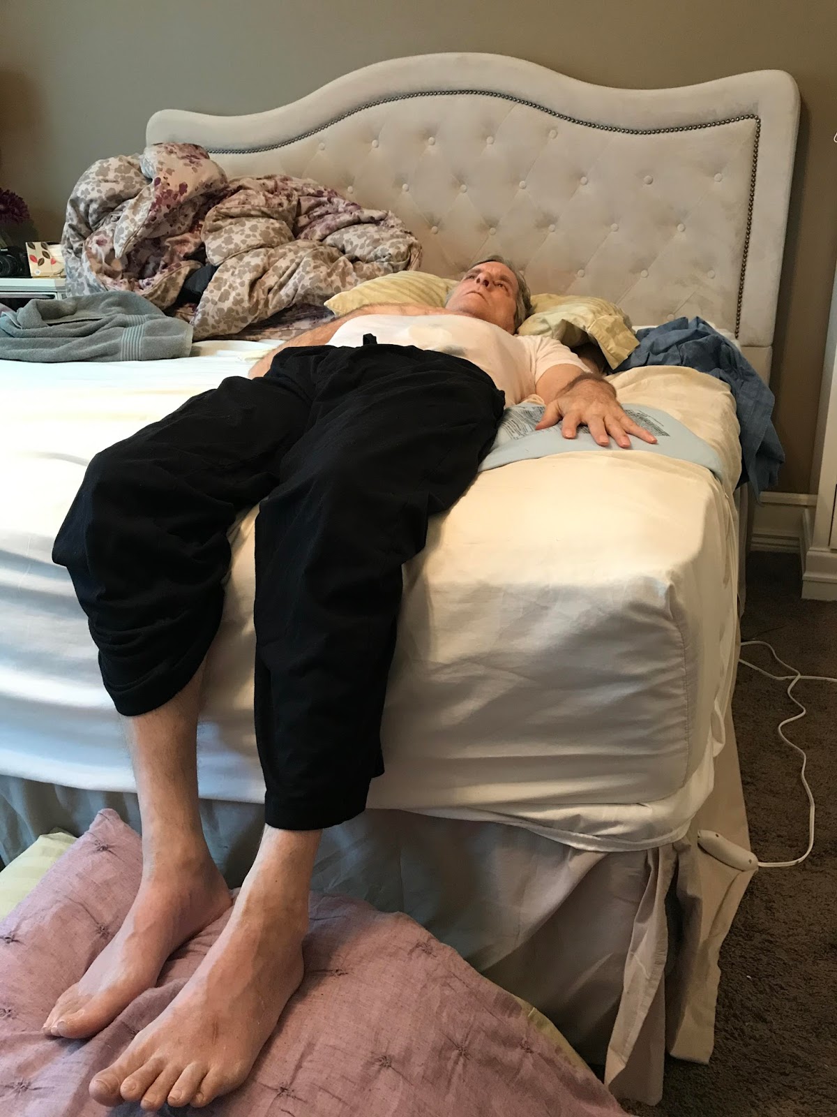 Lumpy Frumpy Kidneys