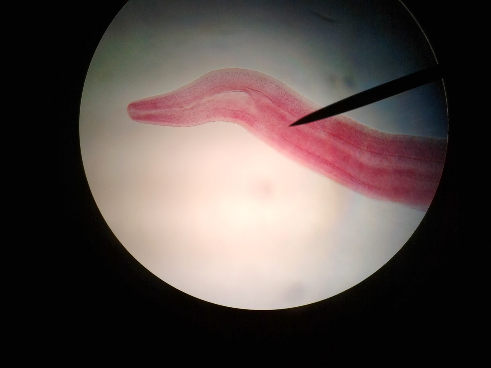 Atlas sobre las practicas de parasitología (Bio Sanitaria): Schistosoma ...