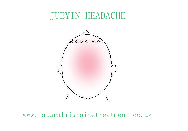 Natural Migraine Treatment: The 6 different types of Migraine related ...