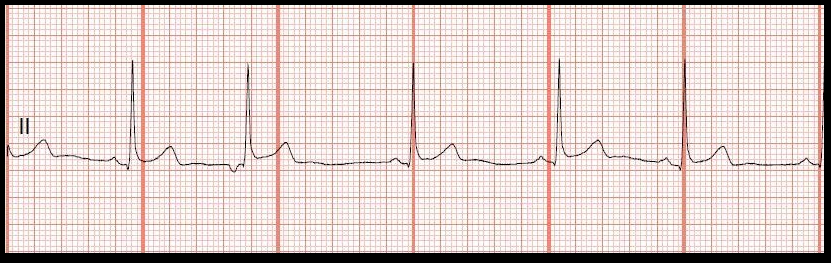Various Rhythms with PJCs